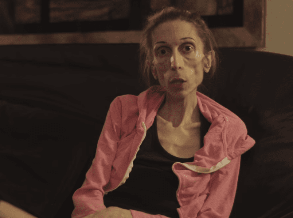 'I Need Your Help': Video Plea from Actress Dying of Anorexia