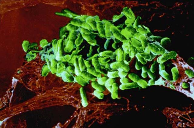 Typhus on Rise in Texas, Say Disease Experts