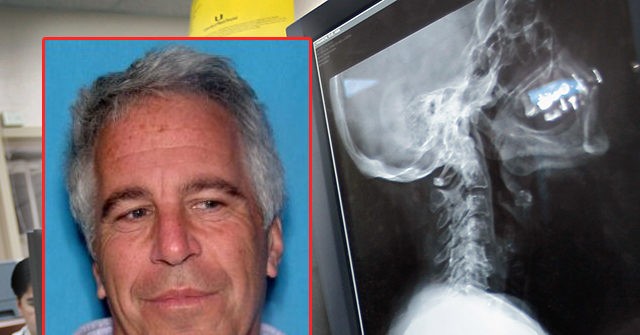 Report: Jeffrey Epstein Autopsy Reveals Broken Neck Bones