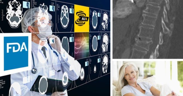 Zebra Medical Vision Secures its 5th FDA Clearance, Making Its ...