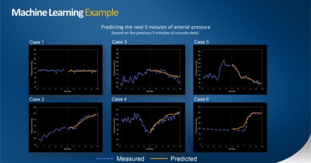 FDA Approves Data Streaming from the Impella Console, Setting the Stage ...