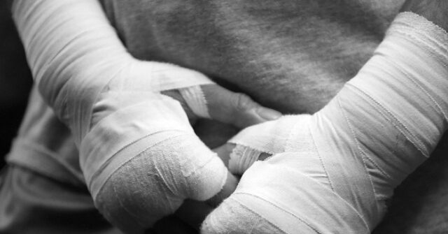 MMA Fighter Suffers Horrific Nose Break After Taking Knee to the Face