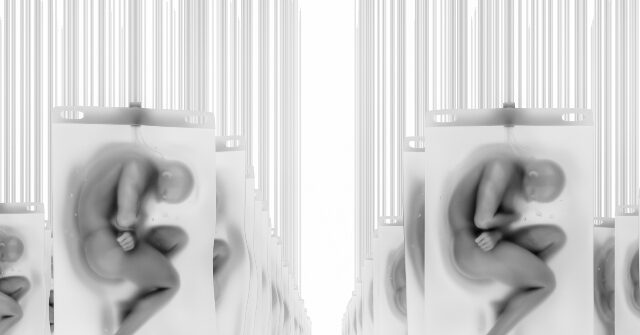 Spare Parts for People: Scientists Are Developing 'Bodyoids' to Supply ...