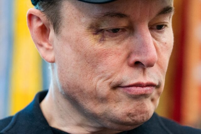 Black eye? That's just from my son, says Musk - Breitbart