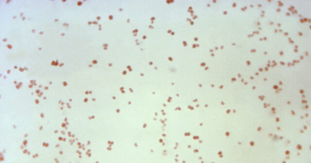 Sexually transmitted disease cases fall, but not syphilis in newborns ...